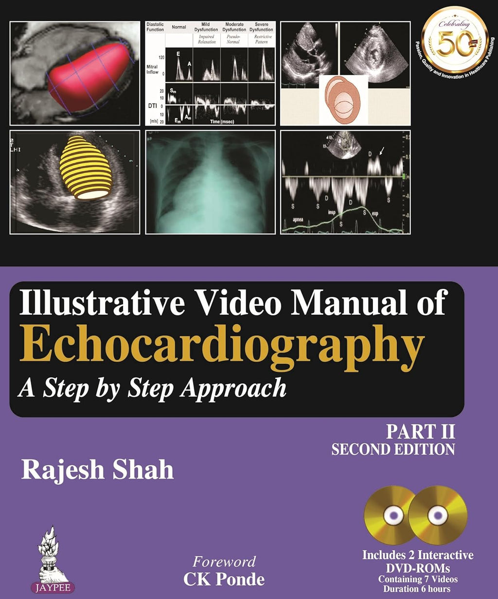 Illustrative Video Manual of Echocardiography: A Step by Step Approach – BookStation