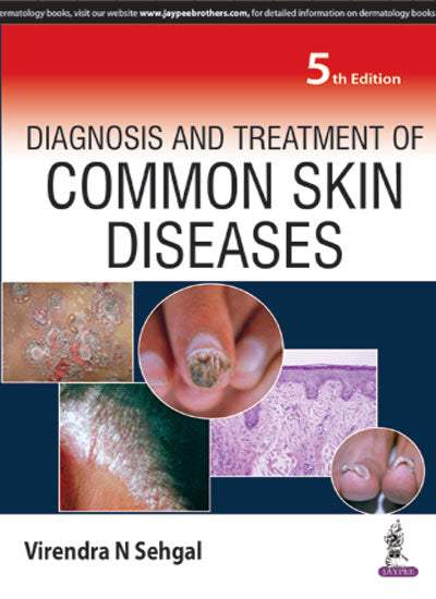 Diagnosis and Treatment of Common Skin Diseases – BookStation