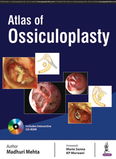 Atlas of Ossiculoplasty (Includes Interactive CD-ROM) – BookStation