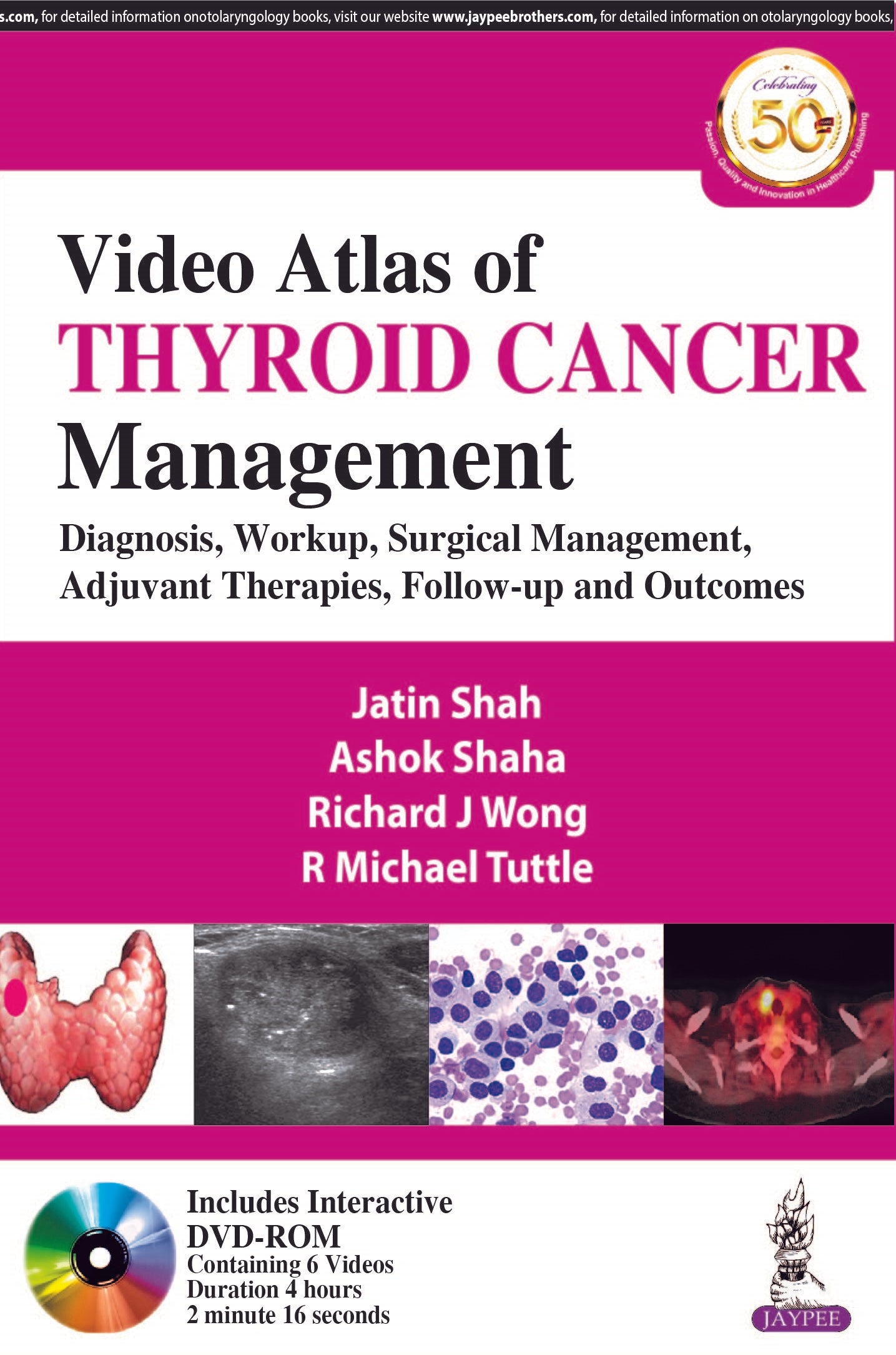 Video Atlas of Thyroid Cancer Management: Diagnosis, Workup, Surgical ...